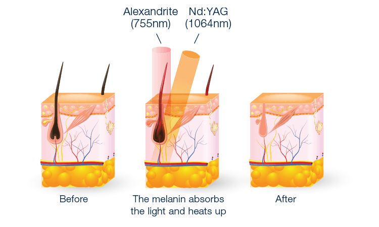 SPLENDOR X - Aesthetipedia